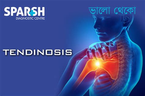 Tendinosis Sparsh Diagnostic Center