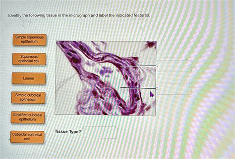 Identify The Following Tissue In The Micrograph And Label The Indicated