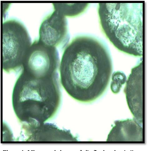 Table 1 From Formulation And In Vitro Evaluation Of Gastroretentive Microballoons Of Riboflavin