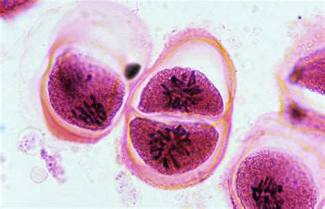 Microscopio Profase 1 Meiose