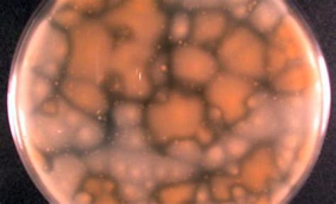 Isolationpartial Purification And Characterisation Of Bacteriocins From Fermented Foods