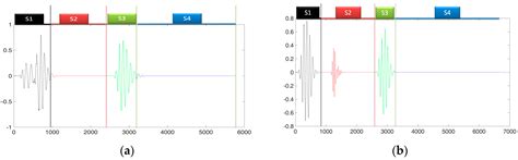 Applied Sciences Free Full Text Classification Of Heart Sound Signal Using Multiple Features