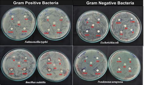 Antibacterial Activity Of Zno And Ag Zno Nps Download Scientific Diagram