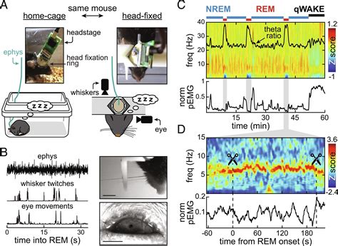 Brain Structures Rem Sleep