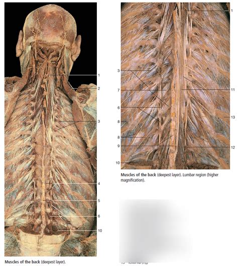 Semispinalis Capitis Cadaver
