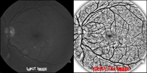 Local Histogram Equalization Studentathome