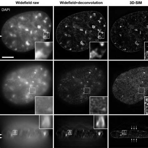 Pdf Subdiffraction Multicolor Imaging Of The Nuclear Periphery With 3d Structured Illumination