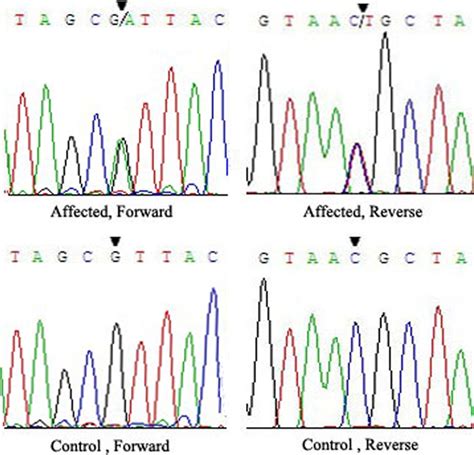 forward and reverse sequence analysis of the affected and unaffected download scientific