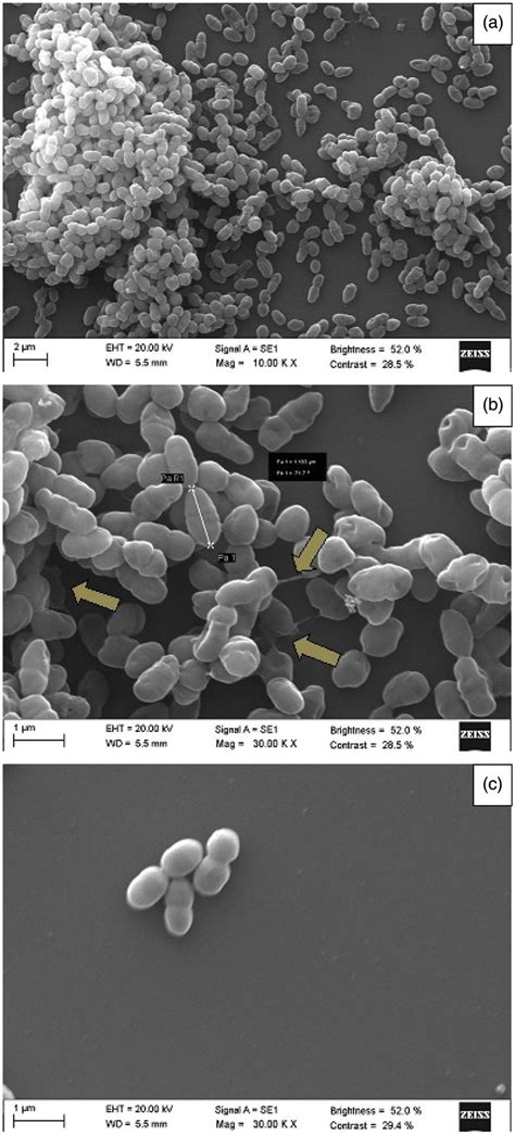 Scanning Electron Micrographs Of Streptococcus Dysgalactiae Subsp Download Scientific Diagram