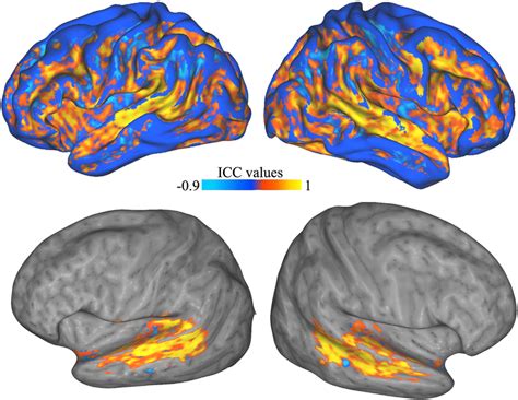 Test Retest Reliability Intra Class Correlation Icc Coefficients Download Scientific Diagram