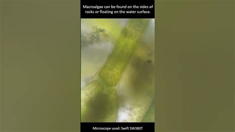 Macroalgae Vs Microalgae Whats The Difference Macroalgae Under The Microscope Microscopy