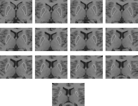 Figure 6 From Novel Approach For Curve Evolution In Segmentation Of