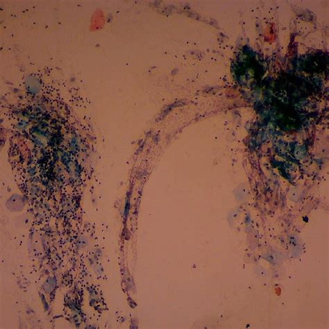 Photomicrograph Showing Abundant Intermediate Cells In Vaginal Smear