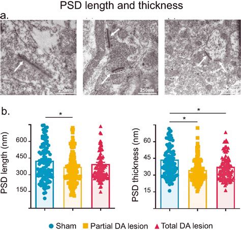 Parabrachial Nucleus Post Synaptic Density A Representative