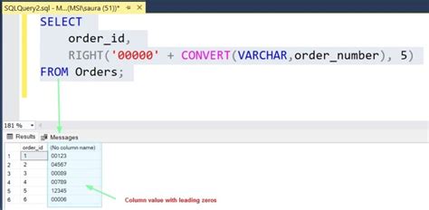 How To Convert Int To String With Leading Zero In Sql Server Sql