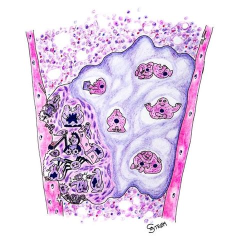 Birmingham Atypical Cartilaginous Tumour Imaging Protocol Bactip Download Scientific Diagram