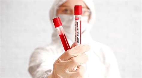 What Is Monkeypox And How Is It Transmitted