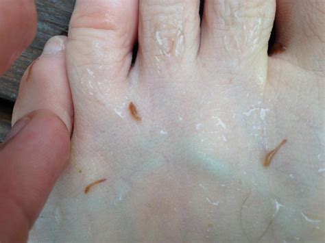 Leech Like Creatures In Pond