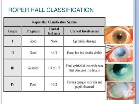 Ocular Chemical Injury