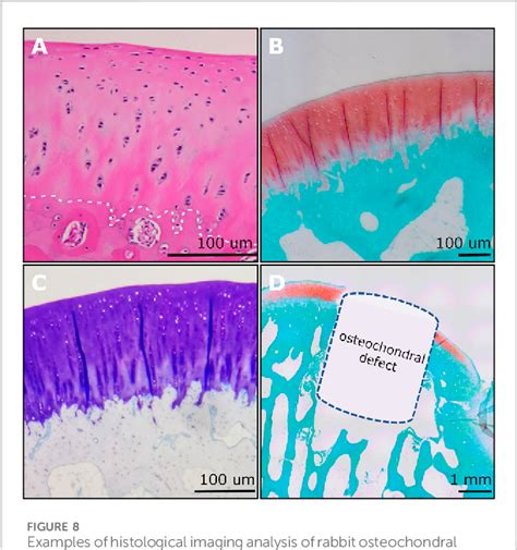 Figure 8 From A Rabbit Osteochondral Defect Ocd Model For Evaluation Of Tissue Engineered