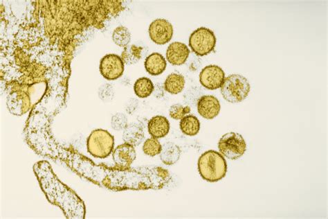 Viral Infections May Accelerate Age Related Cognitive Decline By