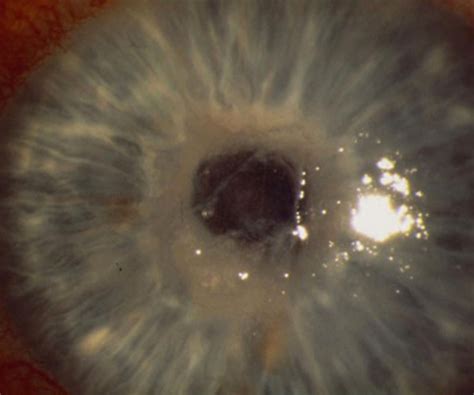 Distinguishing Dendrites Eyeworld