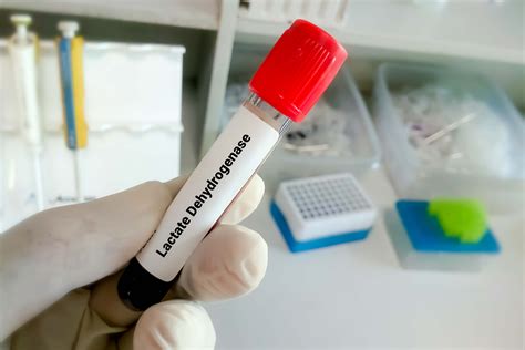 Ldh Test Normal Range Types Procedure And Results