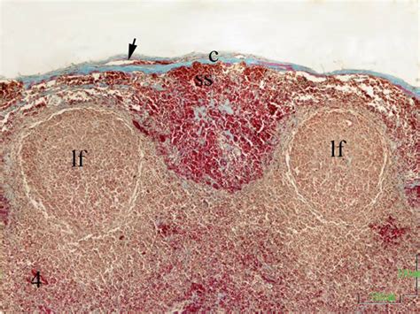 Lymph Node Histology Labeled