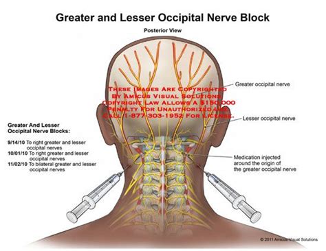 Greater Occipital Nerve Anatomy