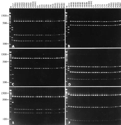Restriction Fragment Length Polymorphism Analysis Of Polymerase Chain