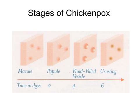 Ppt The Skin In Health And Disease Powerpoint Presentation Free
