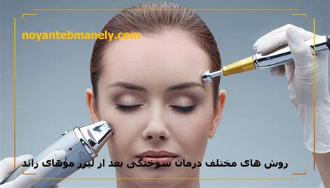 آیا می دانید بهترین روش درمان جای سوختگی بعد از لیزر چیست؟