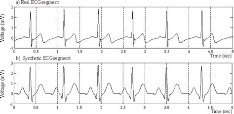 figure 1 from an enhanced emd algorithm for ecg signal processing