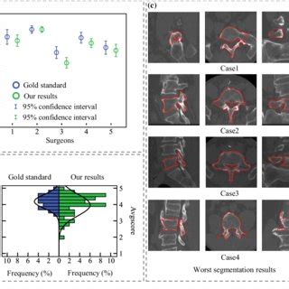 Workflow Of The Vertebrae Segmentation Algorithm Download Scientific Diagram