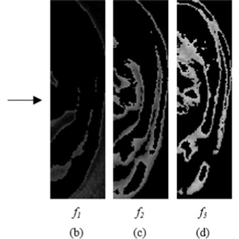A Block Diagram Of The Proposed Greedy Hill Climbing Based Boundary Download Scientific Diagram