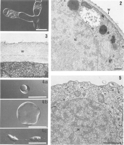 Transmission Electron Micrograph Showing The Fibrillar Structure Ofthe Download Scientific