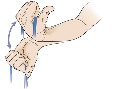 Wrist Flexion Battista Illustration