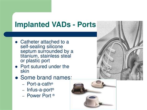 PPT Venous Access PowerPoint Presentation Free Download ID