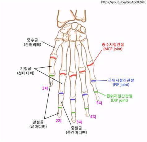 아이플러스 후기와 건강정보 손가락 통증
