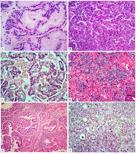 Normal Prostate Cells
