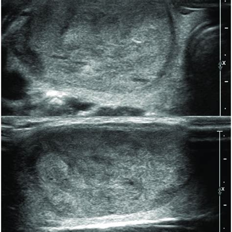 Tirads Classification Algorithm [13] Download Scientific Diagram