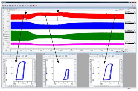 Endocannabinoids And Cardiac Contractile Function Pathophysiological Implications Pmc