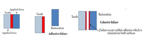 Adhesion Vs Cohesion