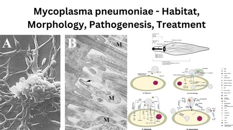 Corynebacterium Diphtheriae Morphology Pathogenesis Treatment Biology Notes Online