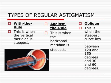 Ppt Astigmatism Powerpoint Presentation Free Download Id 6765680