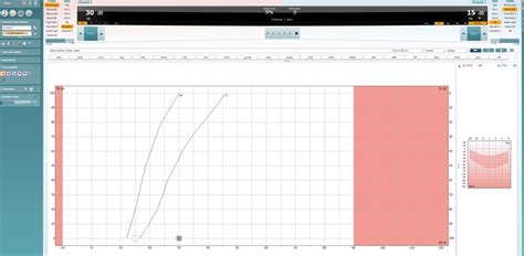How To Perform Speech Audiometry With Equinox Evo Interacoustics