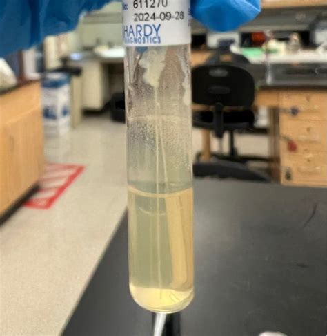 Solved Using Only The Info Below Is My Bacteria Staph