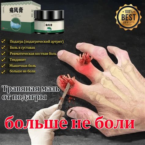 Мазь для суставов обезболивающая для лечения подагры артрита и
