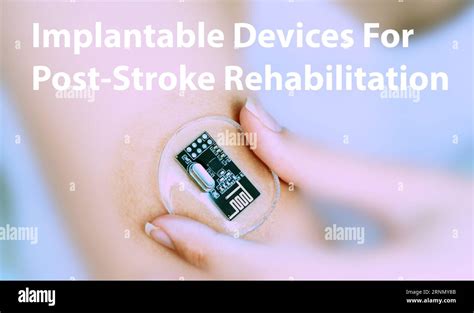 Implantable Devices For Post Stroke Rehabilitation Devices That Provide Neuromodulation