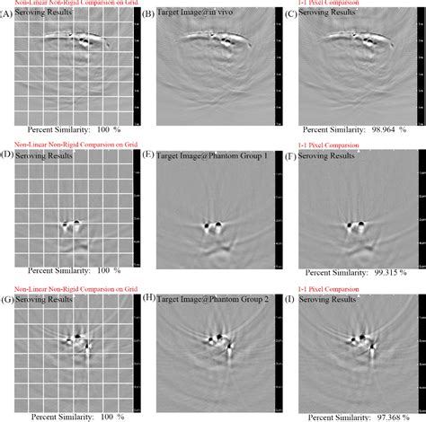 Figure 1 From Robotic Repositioning Of Photoacoustic Tomography For Reproducible Long Term